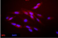SF295 Human Glioblastoma Cell Line | SCC289